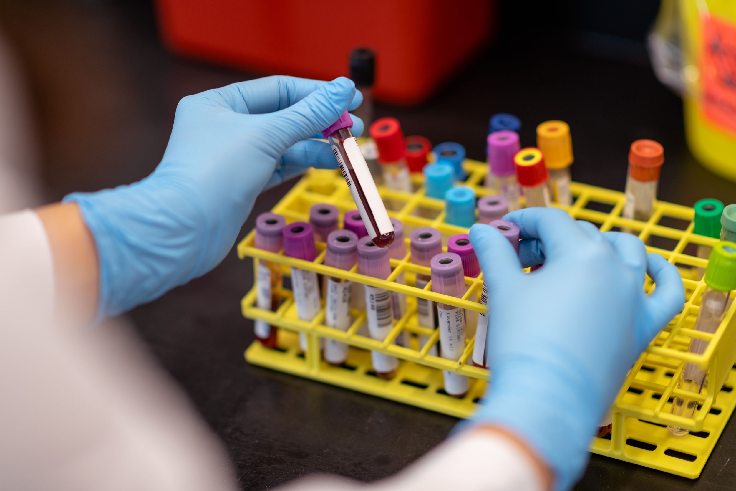 Alzheimer's and Dementia Testing | Quest Diagnostics | Quest Diagnostics